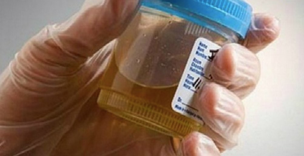 Natural super antibiotic that will destroy a urinary tract infection ...