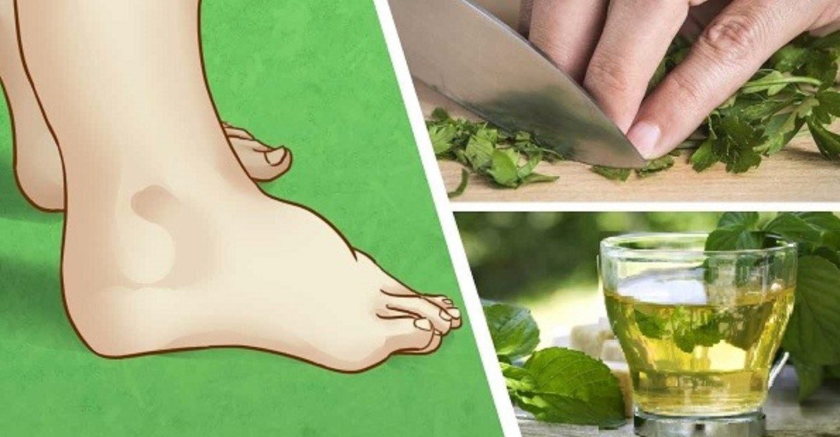 Are your legs swelling in the summer? My aunt advises: This tea will ...