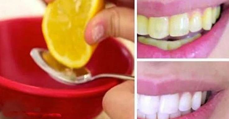 Watch how your teeth whiten in 2 minutes with this homemade paste - i ...