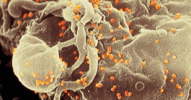 Hope for 37 million patients: Doctors have apparently cured a man with ...