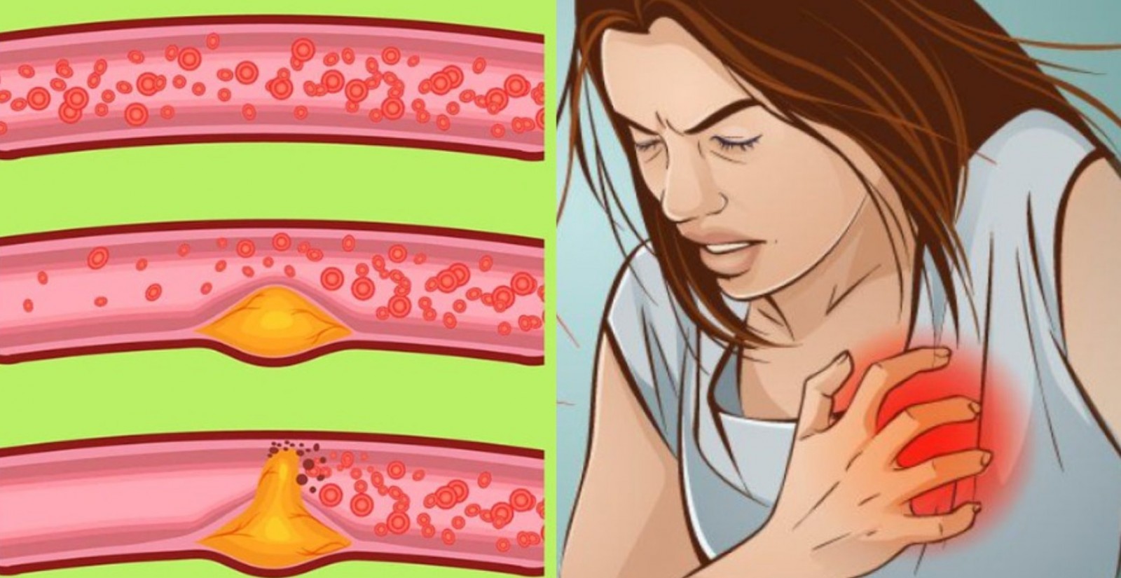 The best diet to lower cholesterol - i-Recipe