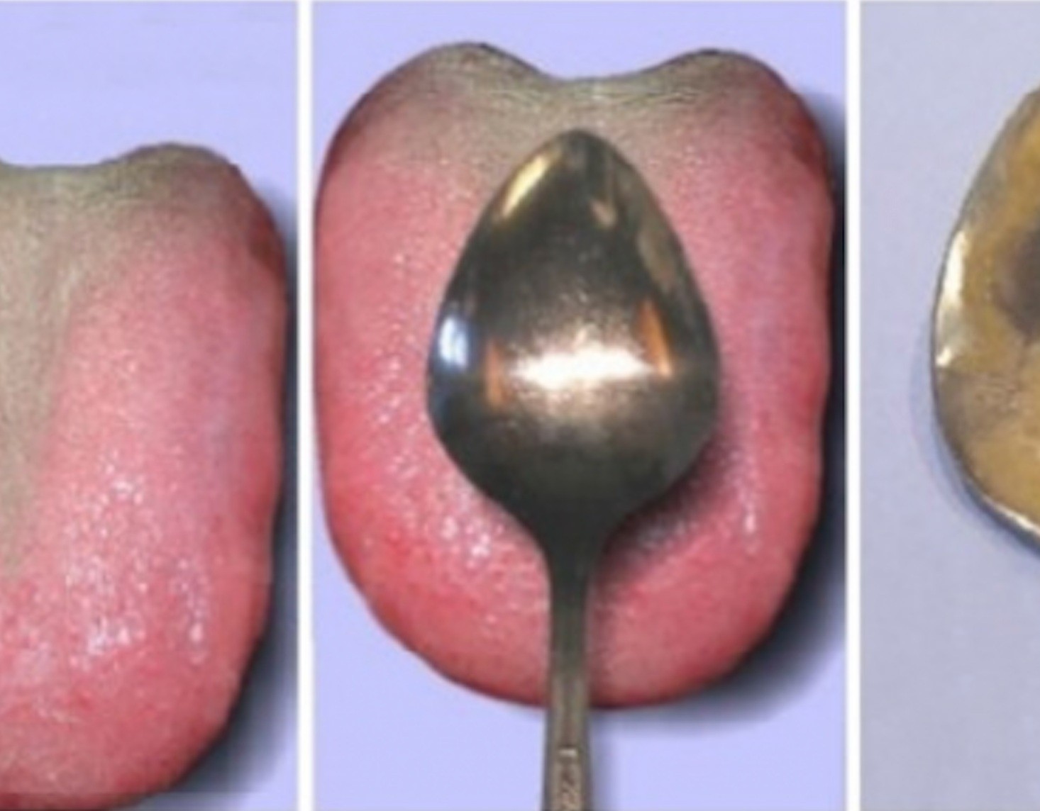A simple spoon test to detect diseases of internal organs in just 60 ...