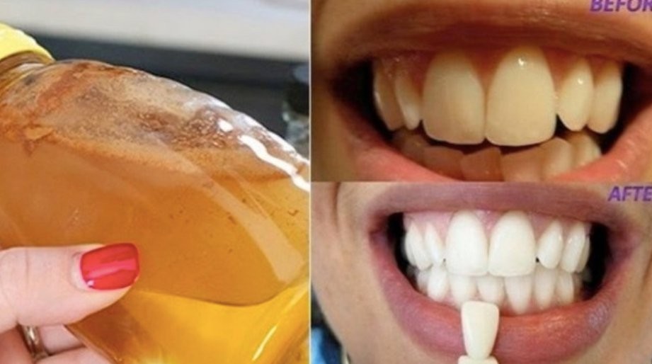Do you long for brilliantly white teeth? Try this home trick for a ...