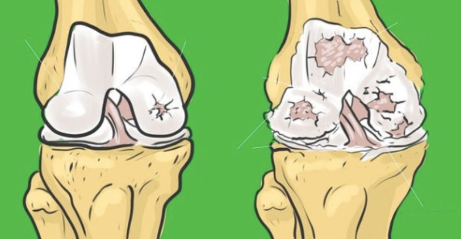 A drink that helps with joint pain. Drink it and problems with the ...