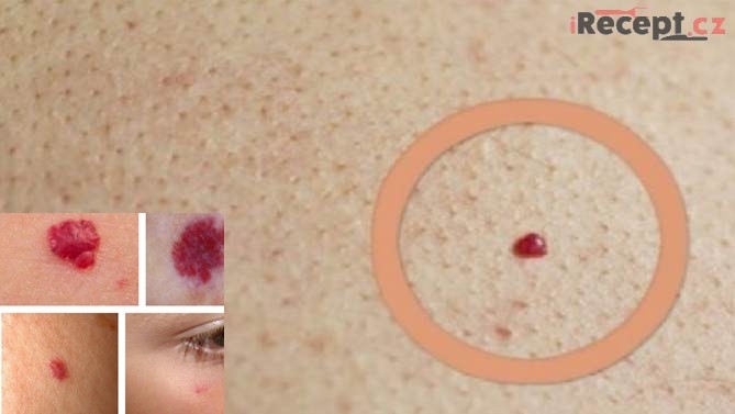 Do you have red spots on your body that weren't there before? See why ...