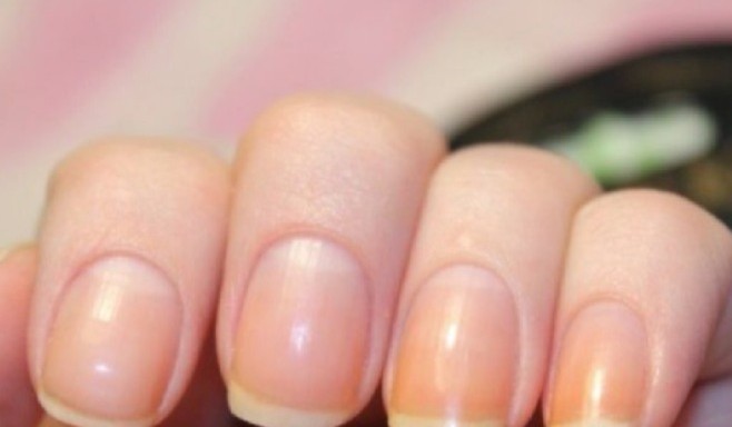 Don't ignore these: 10 hidden signs that you may have a liver problem ...