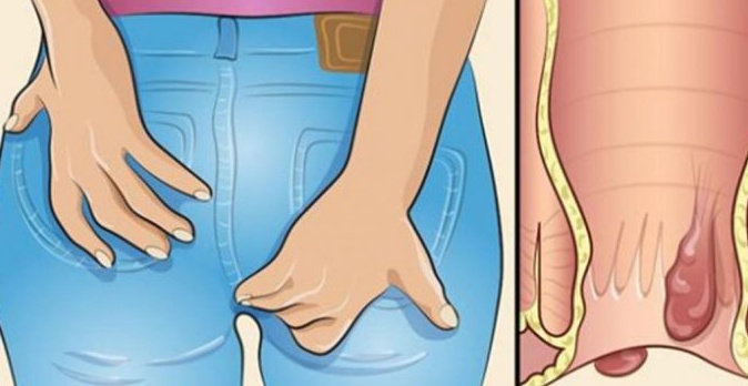 7 things you have at home that will radically help you against ...