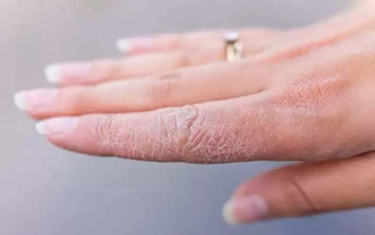 10 lesser-known signs that your thyroid gland isn't functioning ...